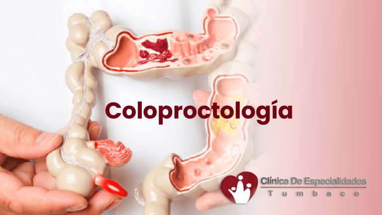 Coloproctología en Tumbaco - Clietsa S.A.