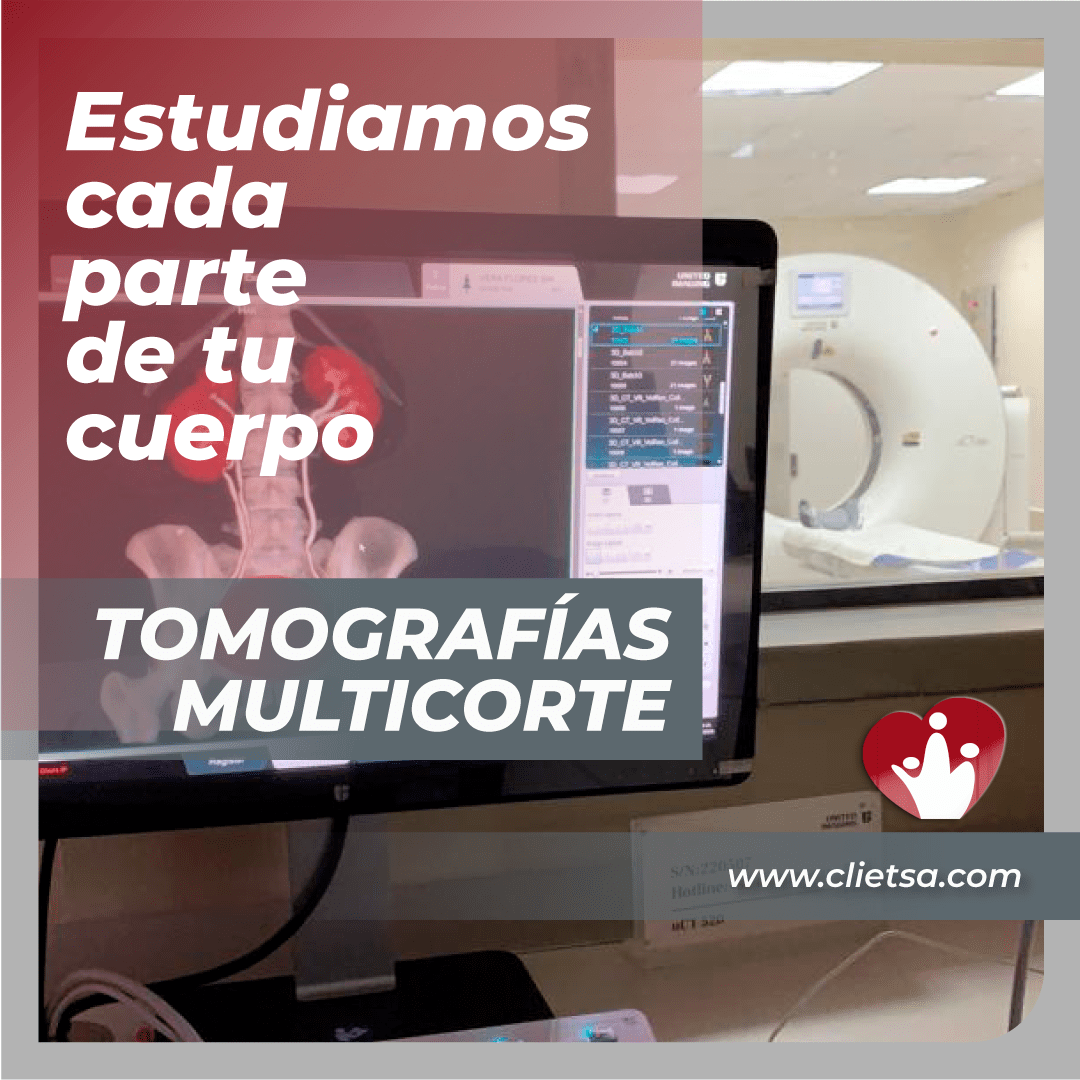 La importancia de la detección temprana del cáncer - Clietsa S.A.